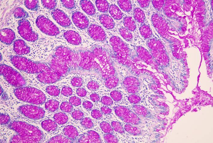 过碘酸雪夫染色液-过碘酸雪夫染色-Pathology Images Database