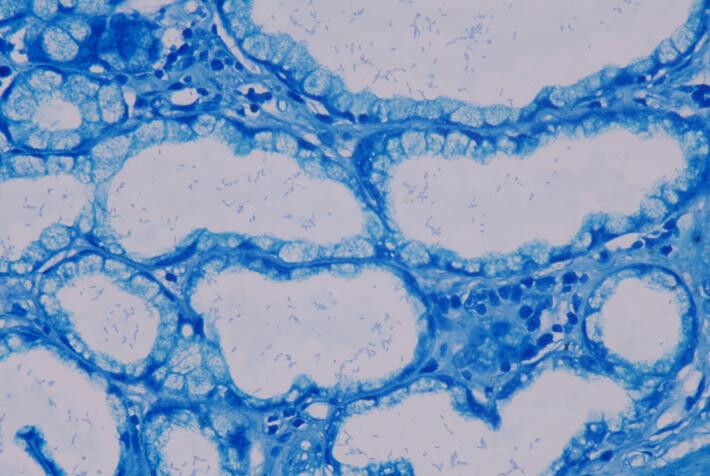 HP染色-HP染色-Pathology Images Database